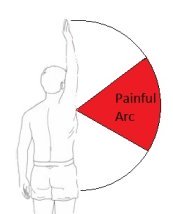 Shoulder Bursitis: Causes, Symptoms & Treatment