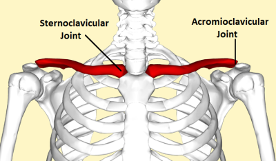 Collar Bone Pain: Common Causes & Symptoms