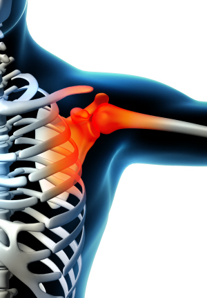 SLAP Tear Shoulder: Causes, Symptoms & Treatment