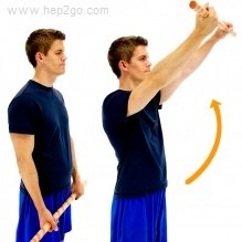 Proximal Humerus Fracture: Causes, Treatment & Recovery